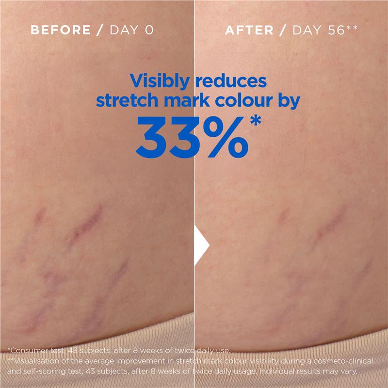 Buy Mixa Body Oil Stretch Mark 100ml Online at Chemist Warehouse®