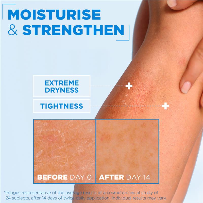 Buy Mixa Body Cream Ceramide Protect Strengthening Cream 400ml Online ...